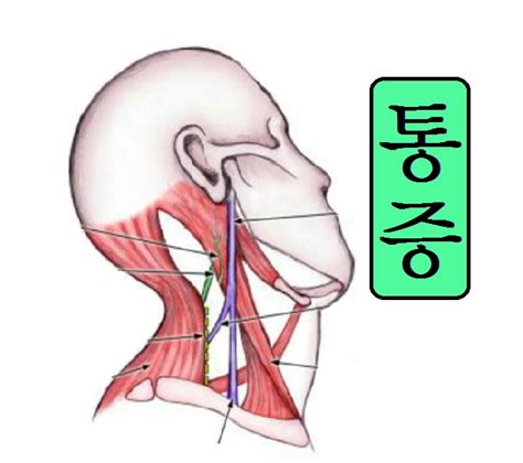 뒤통수 통증 왼쪽 뒷목 통증 관리하려면 네이버 블로그