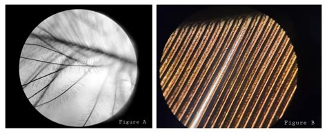 Whats Under The Microscope Answer Trap Pond State Park