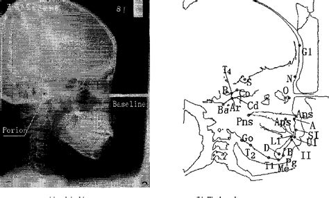 Figure 3 From A Knowledge Based Automatic Cephalometric Analysis Method Semantic Scholar