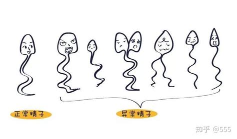 5个步骤教你自判精子质量，如果精液有这些问题，可能影响生育 知乎