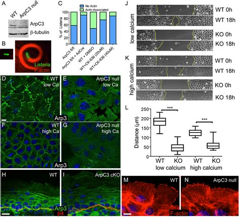 Figure 1 From Actin Related Protein23 Complex Regulates Tight