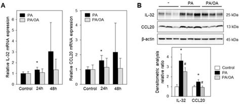 Saturated Fat Mediated Upregulation Of Il 32 And Ccl20 In Hepatocytes