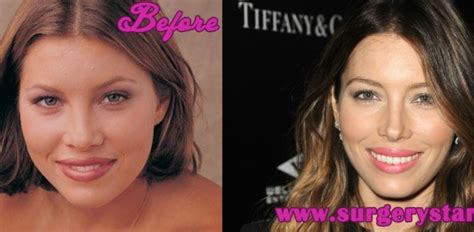 Nose Job Part 2