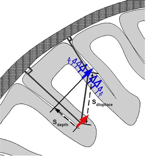 Figure 1 From Assessing And Improving The Spatial Accuracy In Meg