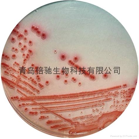 大肠杆菌图片手绘 大肠杆菌用红蓝铅笔画 大肠杆菌红蓝铅笔绘图 大山谷图库