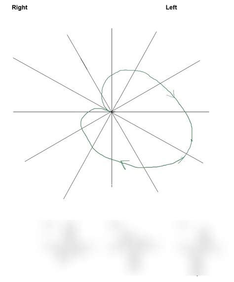 Vectorcardiogram Terms And Definitions For Probability Study Flashcards