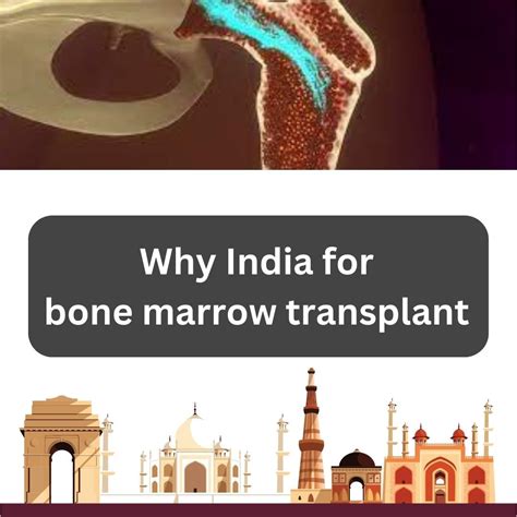 Bone Marrow Transplant In India Know The Best Hospitals Doctors