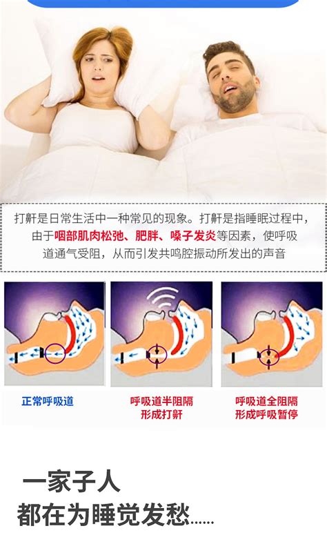 止鼾鼻塞防鼾器阻鼾器鼻塞呼吸器止呼噜器防止打鼾器厂家批发 阿里巴巴