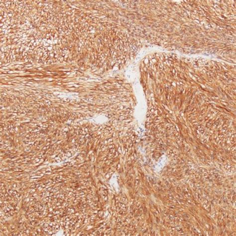 Cd117 Antibody Reagent For Immunohistochemistry Fardadazma