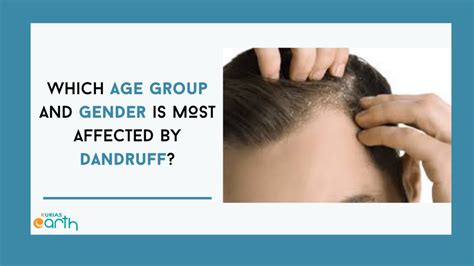 How Is Dandruff Formed