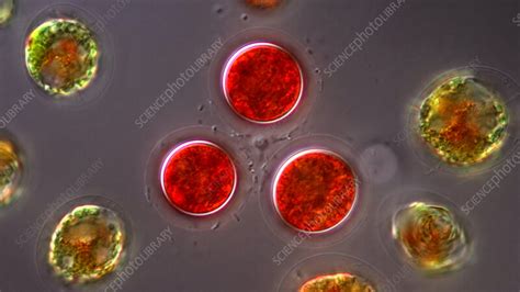 Haematococcus Pluvialis Algae Flagellate Form Microscopy Stock