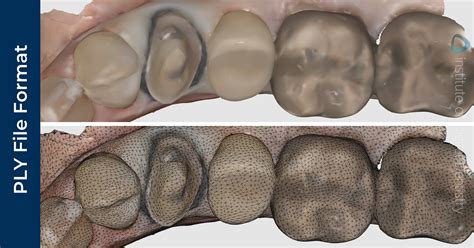 Understanding STL PLY And OBJ Files In Digital Dentistry Institute Of Digital Dentistry