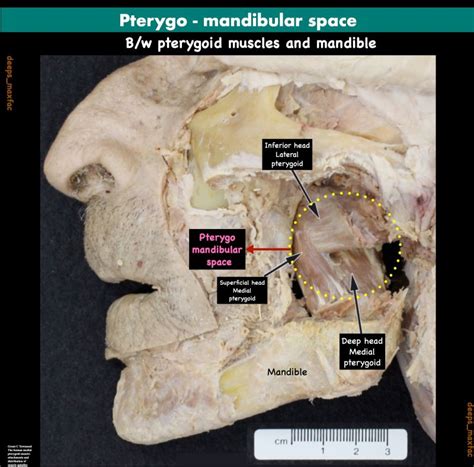 Pterygomandibular Space🔆 Dr M Deepa