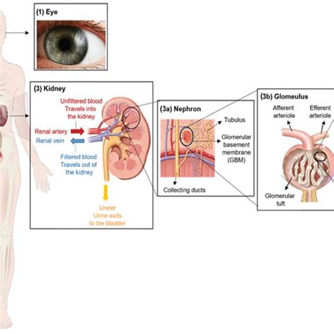 An Approach Regarding The Evaluation And Classification Of Alport
