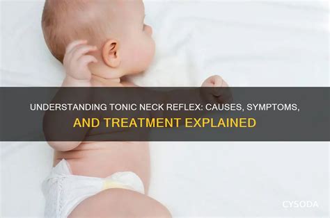 Understanding Tonic Neck Reflex Causes Symptoms And Treatment Explained Cysoda