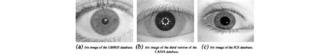 Examples Of Close Up Iris Images Of The Databases Used In Our