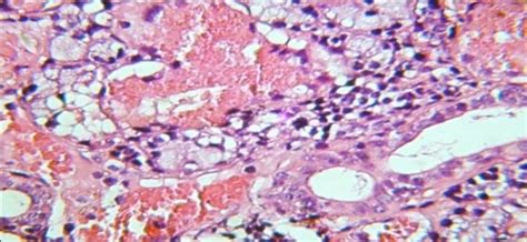 Histopathological Section In Thyroid Gland Of Rat In Chronic At 60 Day Download Scientific