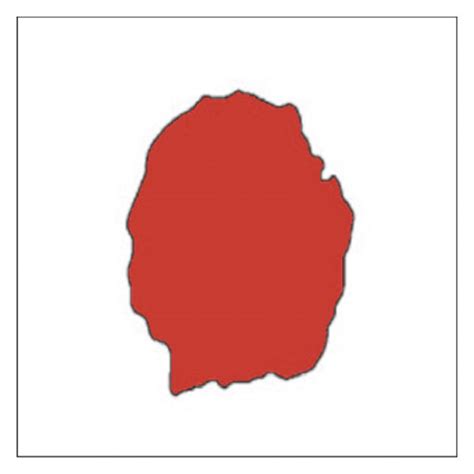 Two Sample Examples Of Skin Cancer Segmentation Based On The Proposed Download Scientific
