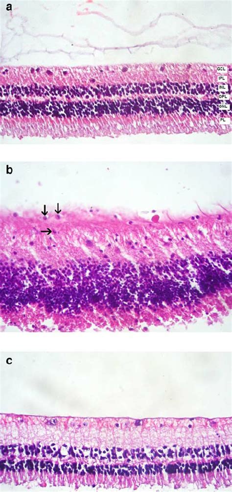 Inner Plexiform Layer Thickness Of Control Ischemia And Download Inner Plexiform Layer Thickness Of Control Ischemia And Download