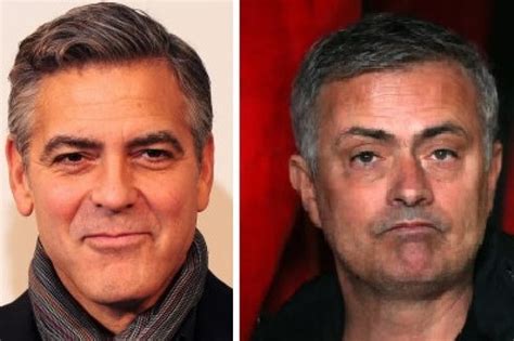 Hair Transplant What To Expect Post The Ppocedure