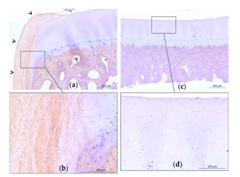Representative Light Micrographs Of Osteochondral Sections Of The