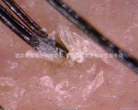 500x Scalp Bacteria Scope（2 0m Pixels） Cbs 605 Cbs China