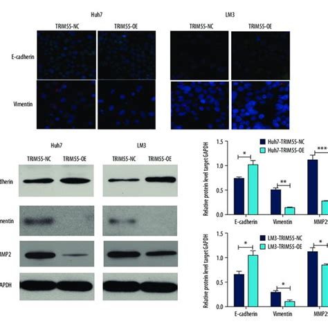Overexpression Of Trim55 Inhibits Migration And Invasion Of Hcc Cells