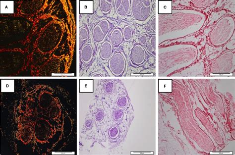 Peripheral Nerve Histology Cross Section