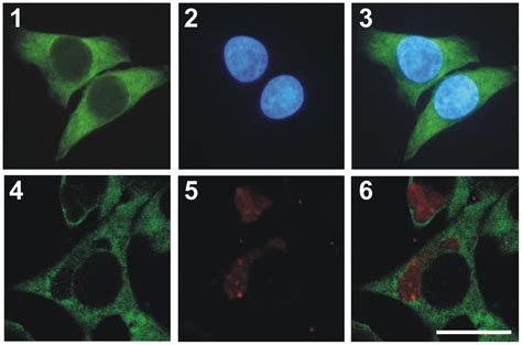 G3bp1 Is Accumulated Around The Chlamydial Inclusion In Cp Psittaci