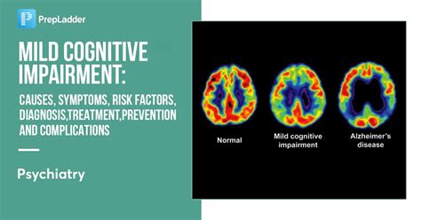 Mild Cognitive Impairment Causes Symptoms And Complications