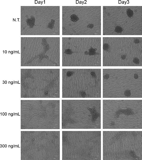 Figure 1 From Deactivation Of Hepatic Stellate Cells By Culturing On