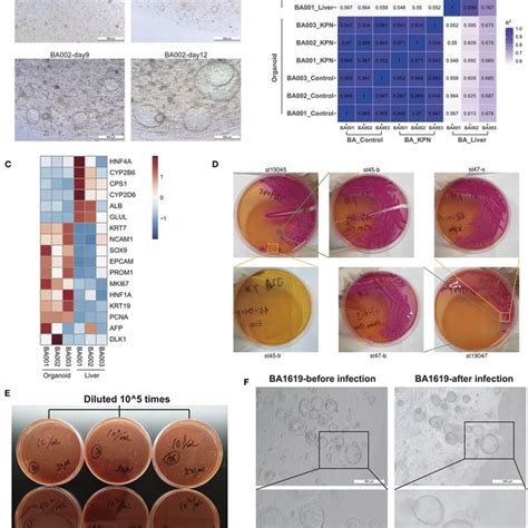 Organoids May Be An Appropriate Model For Ba And Post Kasai