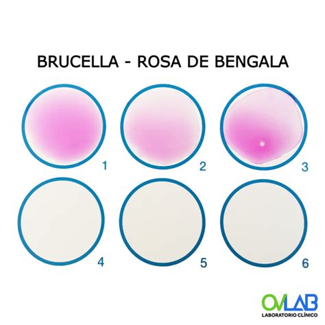 BRUCELLA ROSA DE BENGALA OVLAB O V Laboratorios