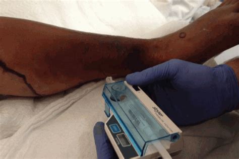 The Knee And Leg Musculoskeletal Key