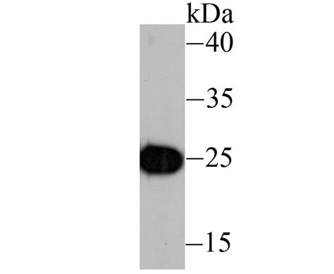 Il 6 Monoclonal Antibody 1 6 Ma5 45070