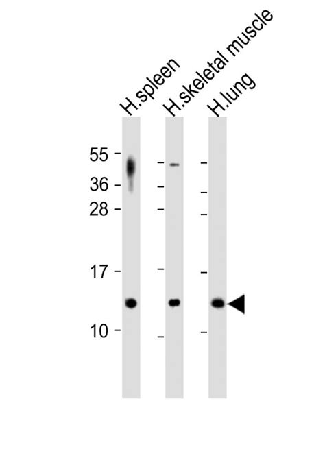 Human Ccl17tarc Elisa Kit Price Picokine® Bosterbio