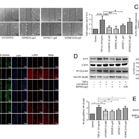 Endmt Is Induced By Tgf β1 In Huvecs A Effect Of 10 Ngml Tgf β1 On Download Scientific