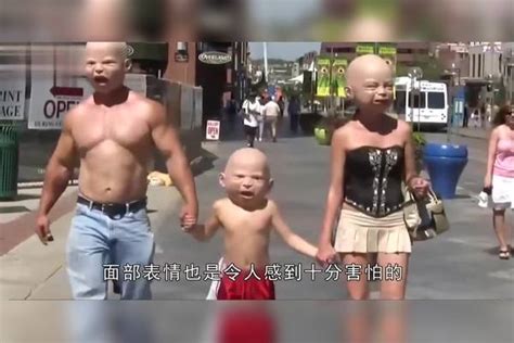 外国街头出现“大头娃娃”，路人被吓到，背后原因让人心酸！娃娃大头路人