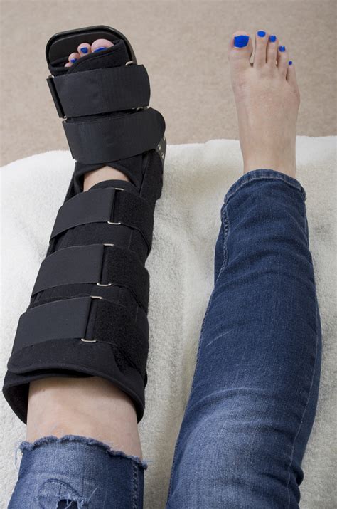 Tibia Fracture Moon Boot At Gary Delariva Blog