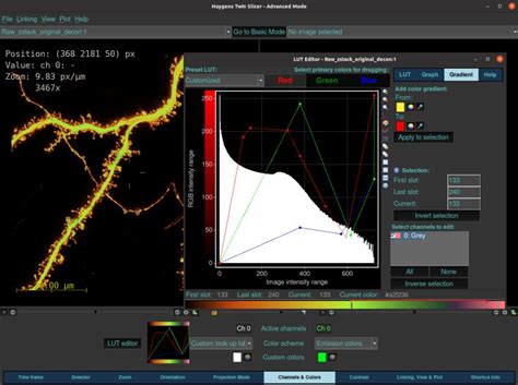 Scientific Volume Imaging On Linkedin Microscopists Webinar Imaging