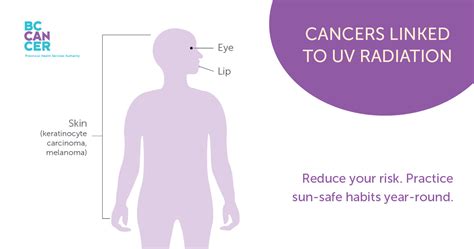 Do X Rays Cause Skin Cancer At Chelsea Sommerlad Blog