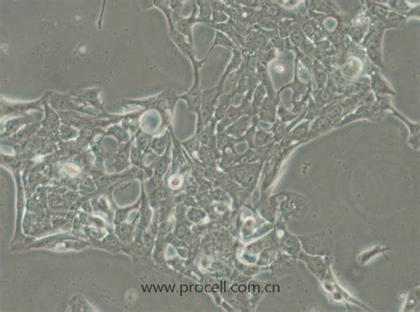 Hcc70 人乳腺导管癌细胞 Str鉴定正确 武汉普诺赛生命科技有限公司 您身边的细胞专家【官方网站】