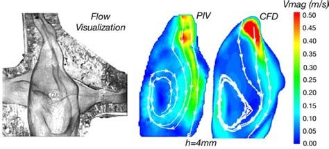 Assessment Of The Flow Field Using Flow Visualization Left… Piv