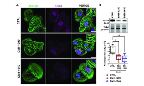 Disruption Of Gap Junction Proteins On The Membrane Of Dm1 Hipsc Cms