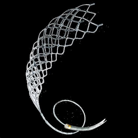 Catchview Stent Retriever System Kalteq