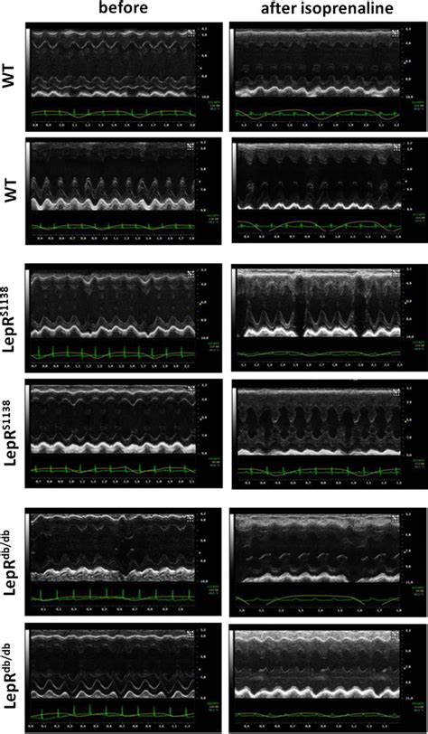 Representative M Mode Echocardiography Recordings Download