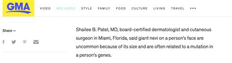 Shailee Patel Md Minars Dermatology