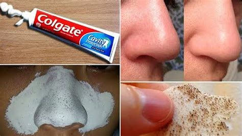 Does Toothpaste Remove Dead Skin At James Ivery Blog