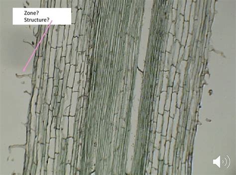 Bio 213 Plant Histology Practice Quiz Flashcards Quizlet