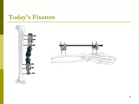 External Fixator Ppt